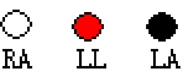 ECG color coding; leadwires